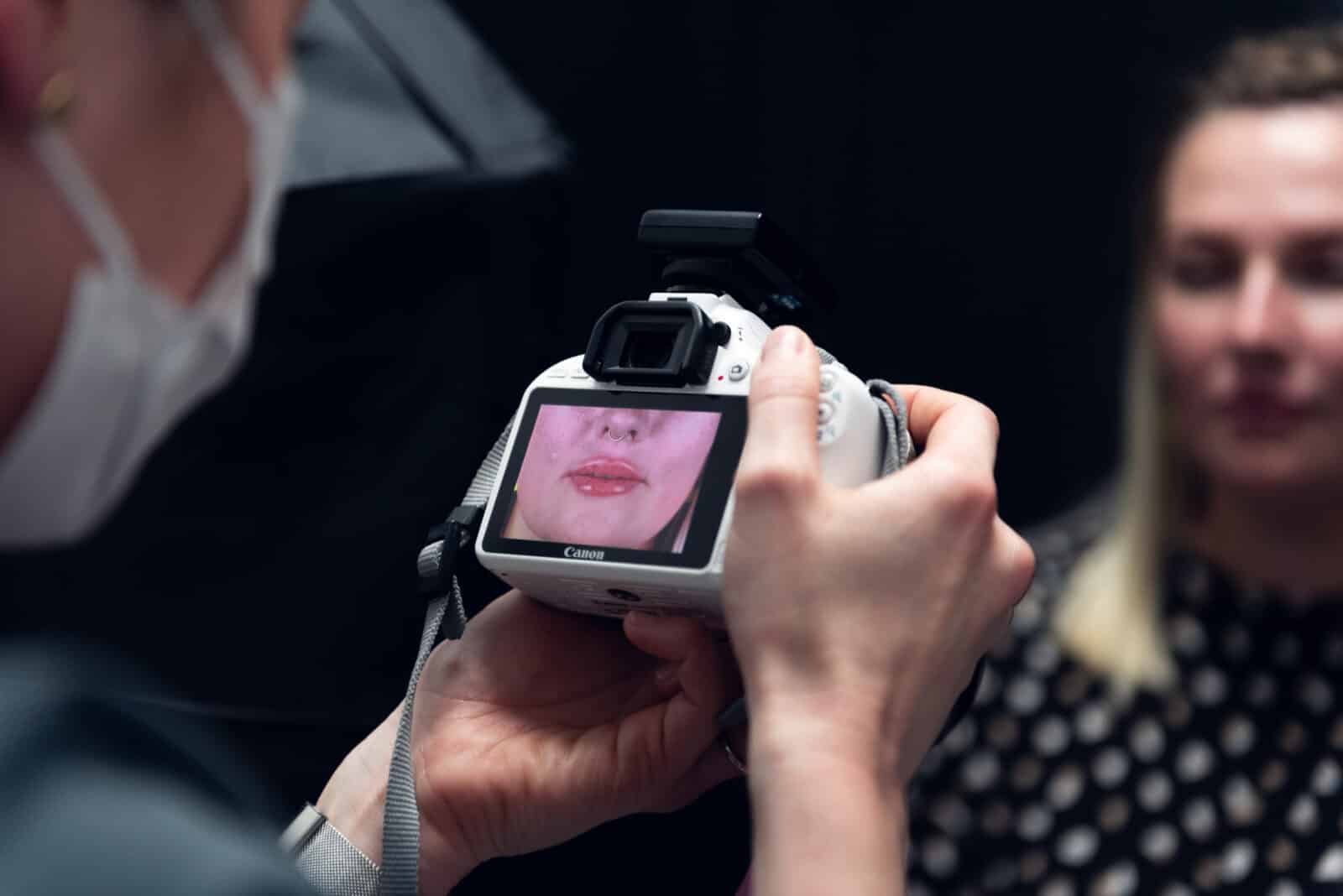 Mastering Lip Filler Injection Techniques: A Comprehensive Guide