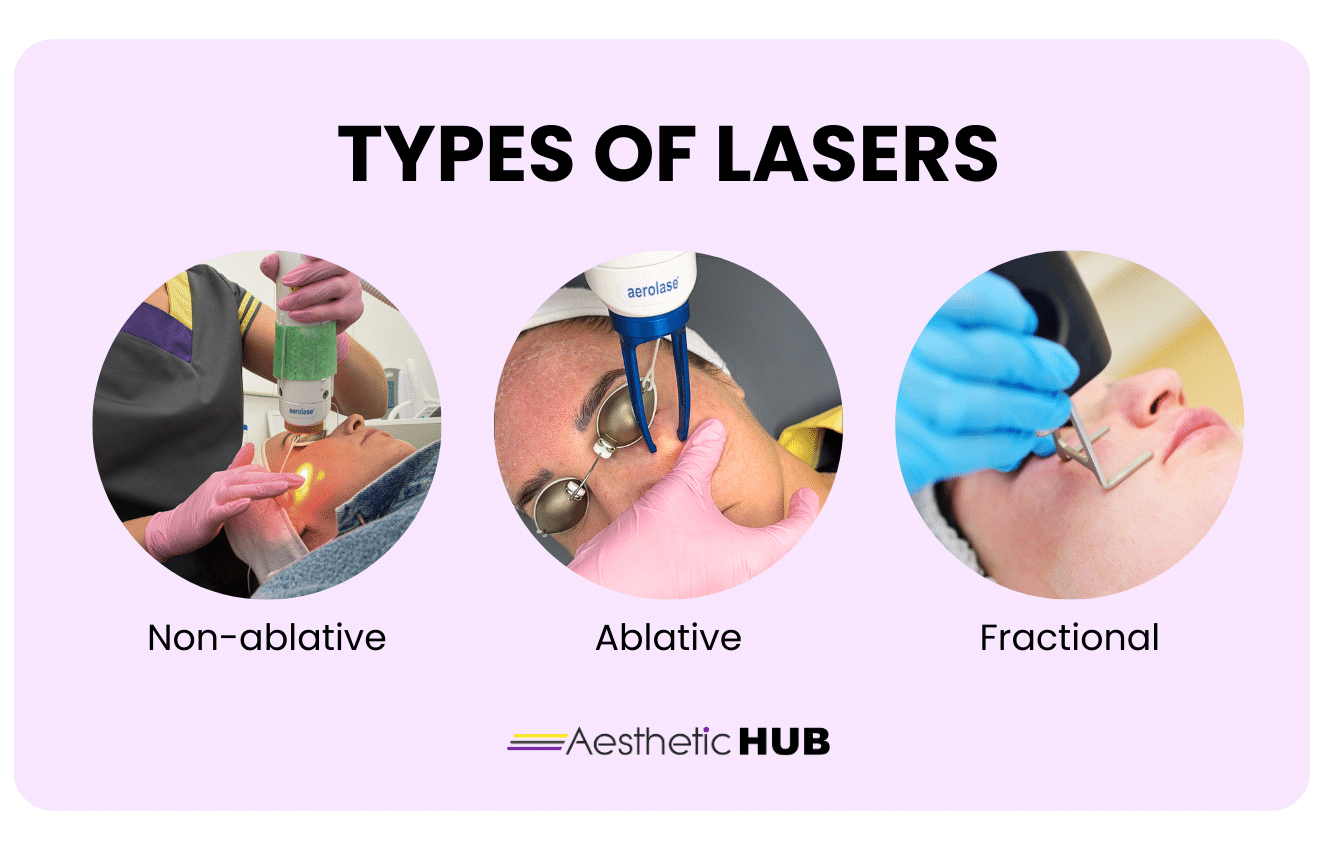 The Best Types of Laser Treatments for Face