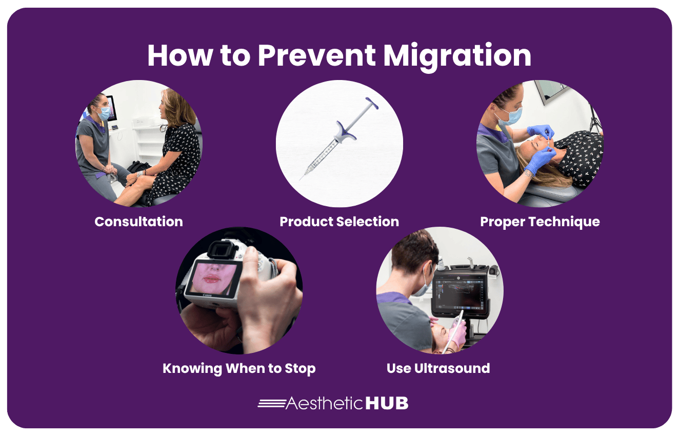 How to Fix Lip Filler Migration: A Practitioner's Guide
