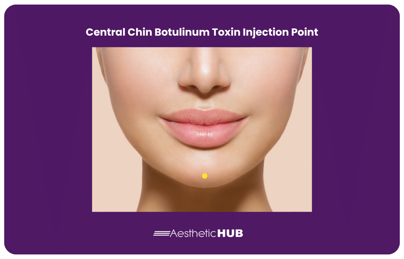 Chin Botox: The Best Fix for Dimpled or Pebbled Chins